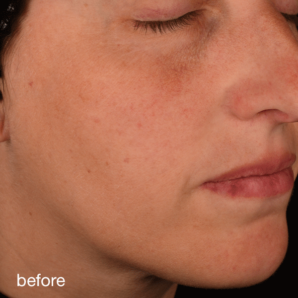 Introducing Pro Collagen Banking Serum – Dermalogica AU