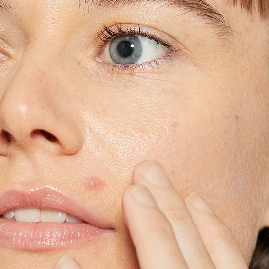 Deep Breakout Liquid Patch – Dermalogica AU