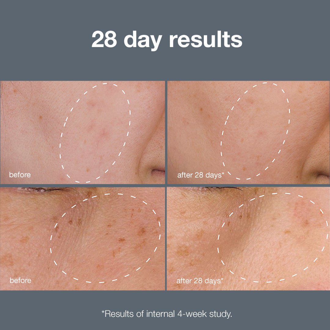 PowerBright Dark Spot System – Dermalogica AU